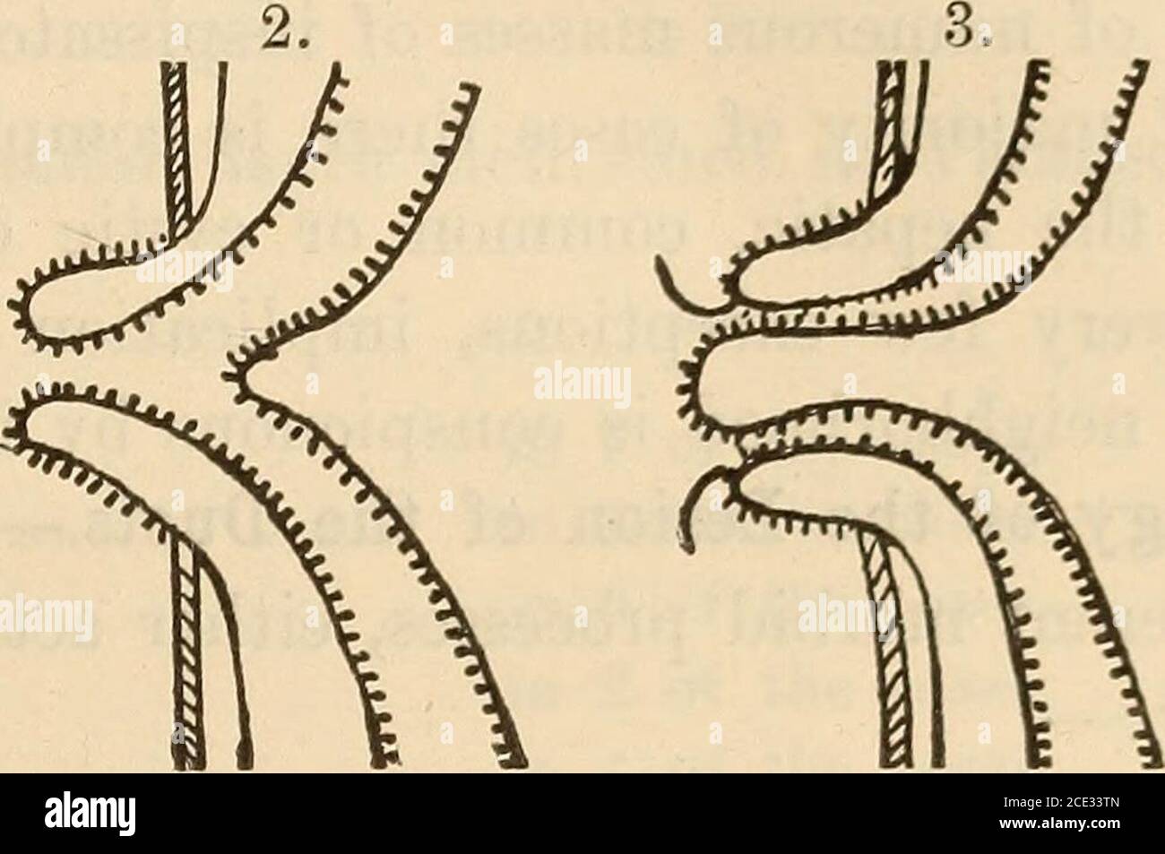 . Diseases of infancy and childhood . Duct and Formation of the So ...