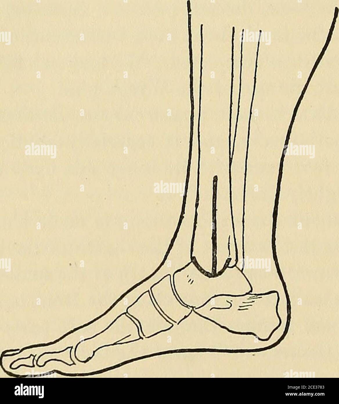 External incision hi-res stock photography and images - Alamy