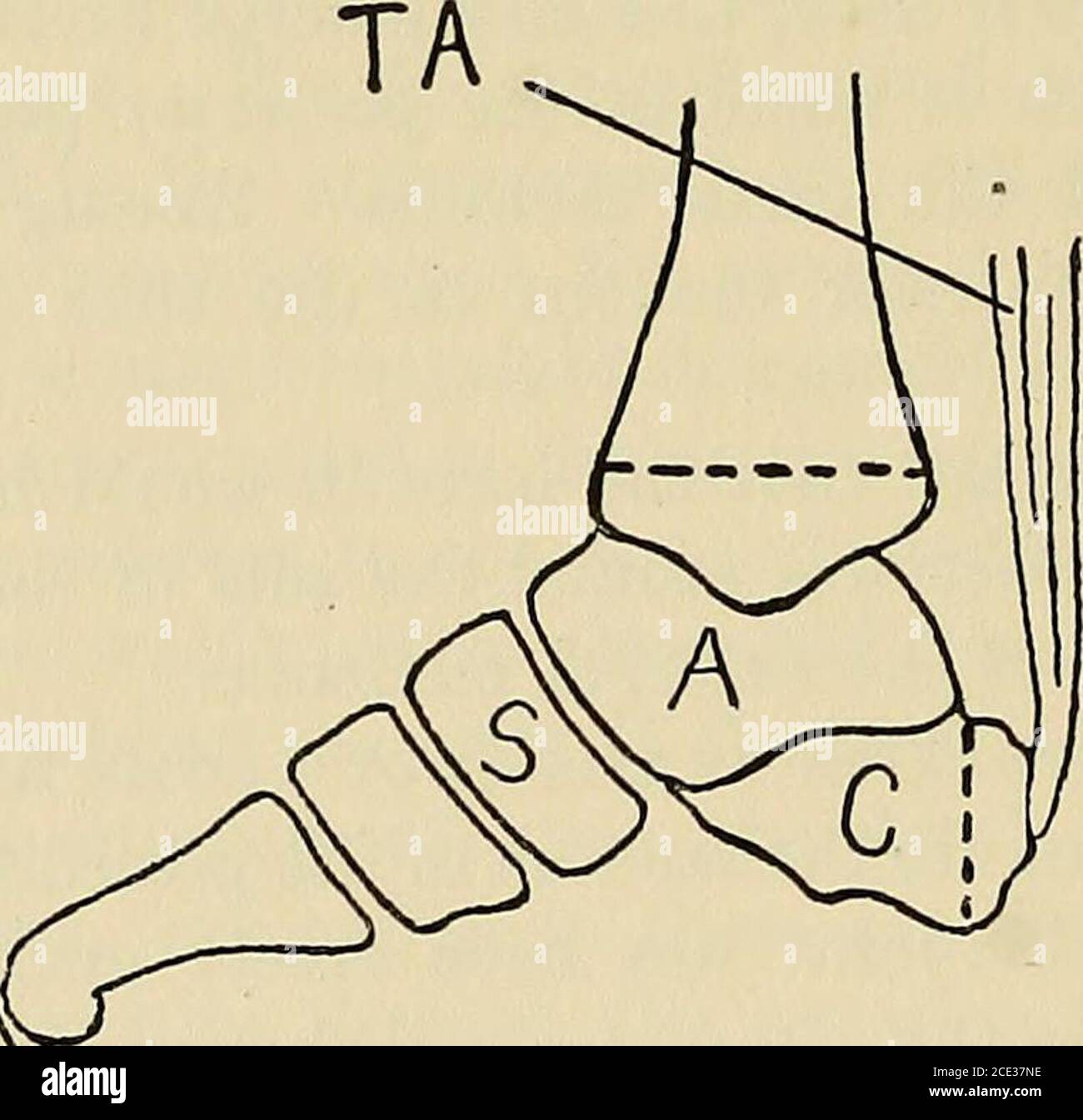 . Operative surgery, for students and practitioners . to the long axis ...