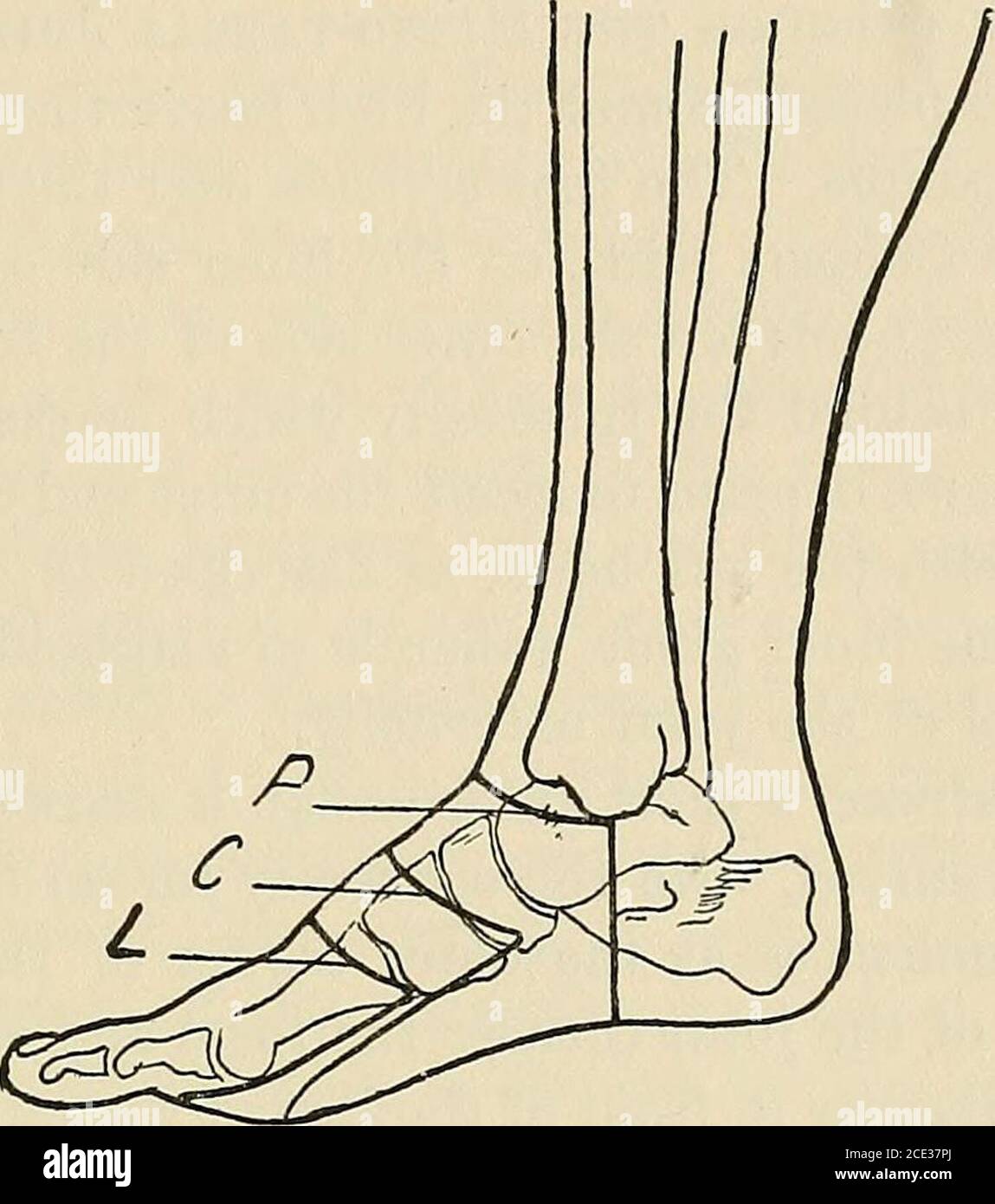 . Operative surgery, for students and practitioners . toes, and carried ...
