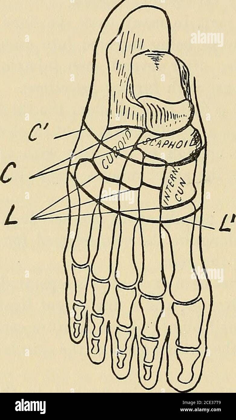 . Operative surgery, for students and practitioners . foot, or, if an ...