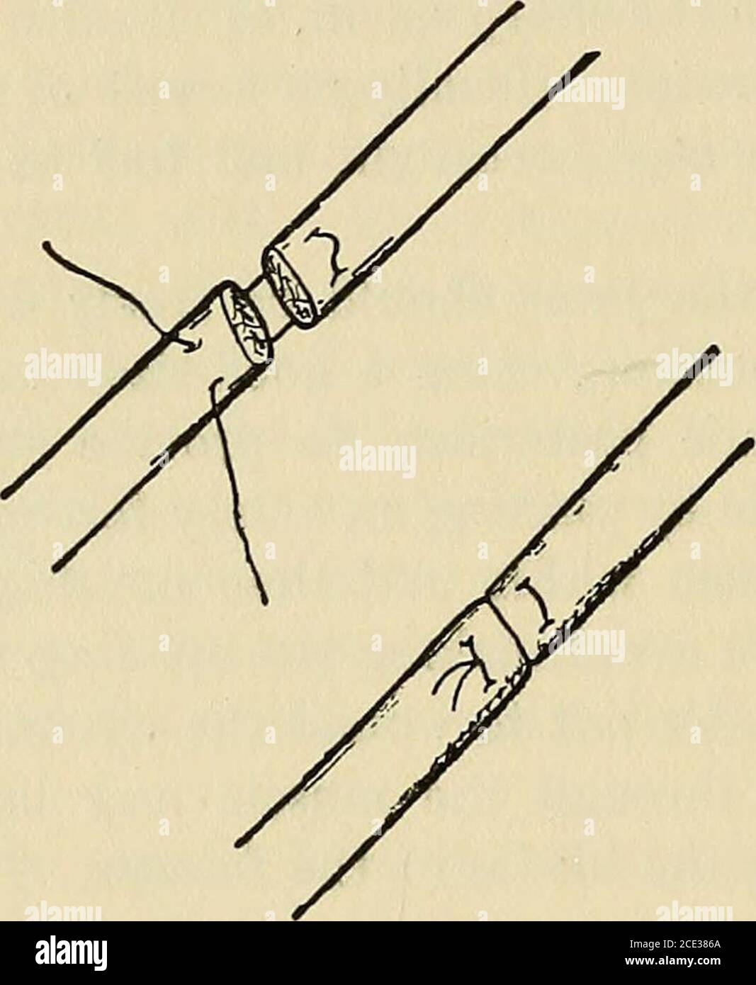. Operative surgery, for students and practitioners . dons for a ...