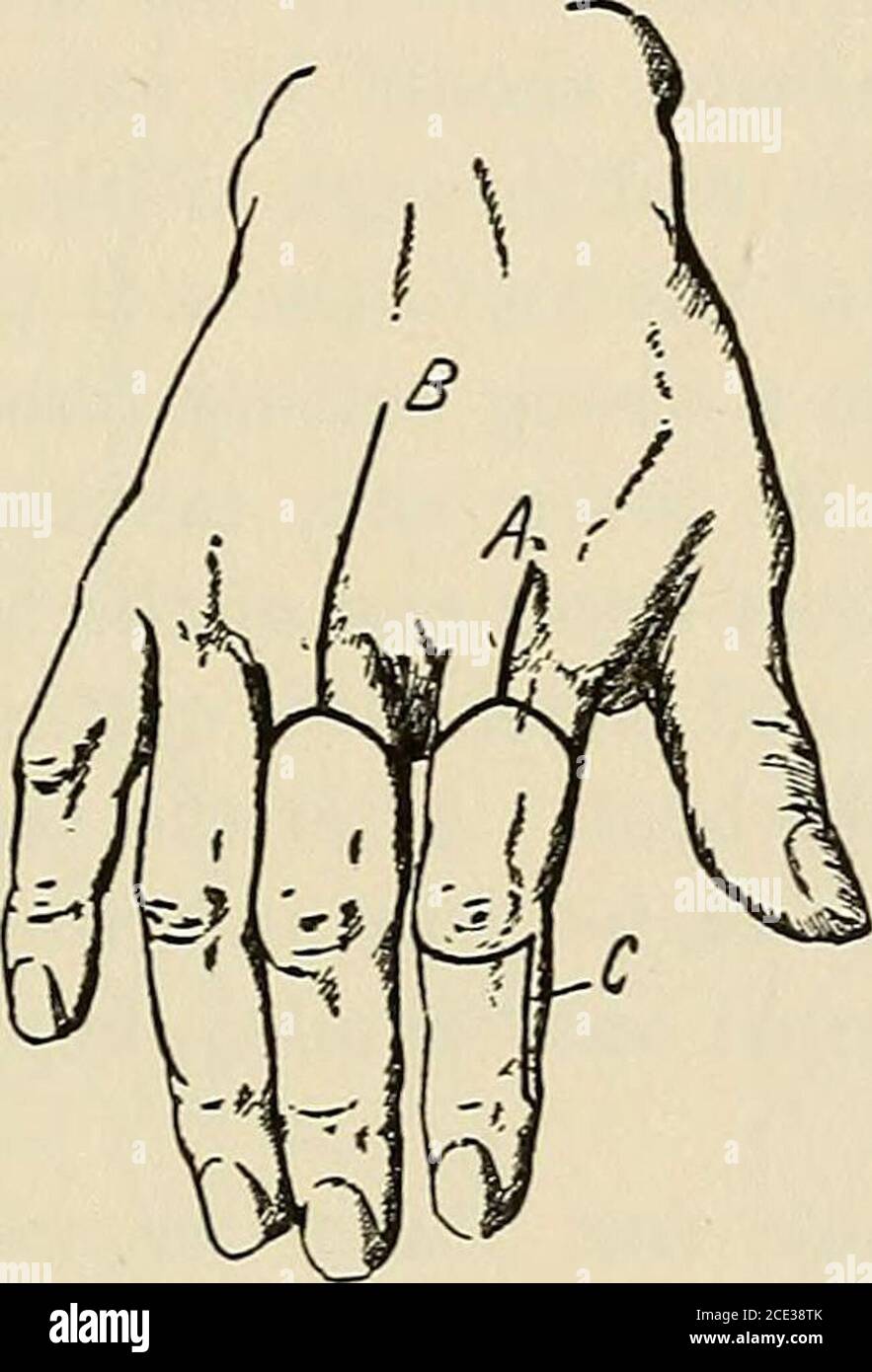 . Operative surgery, for students and practitioners . d off ...