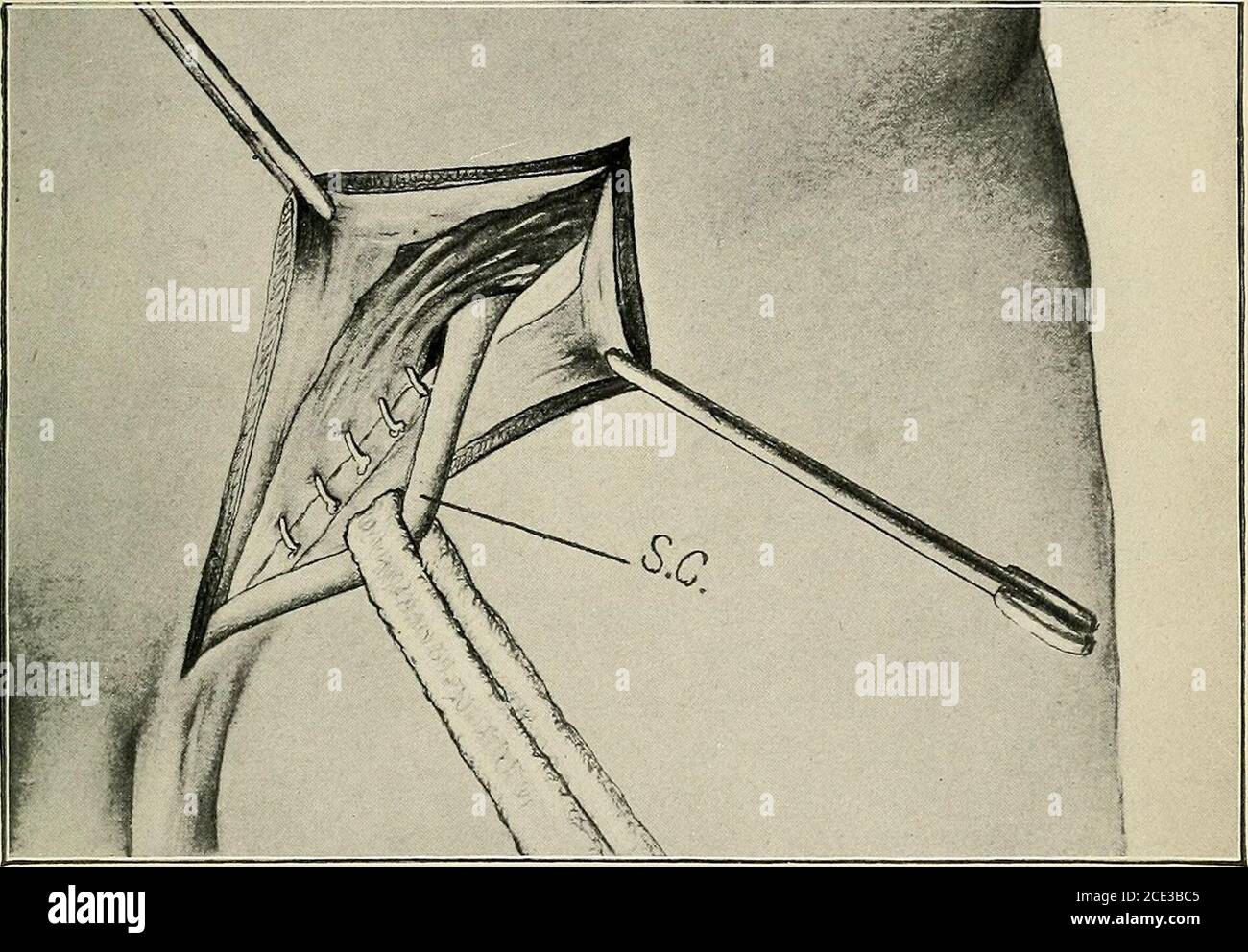 . Operative surgery, for students and practitioners . ll are introduced ...