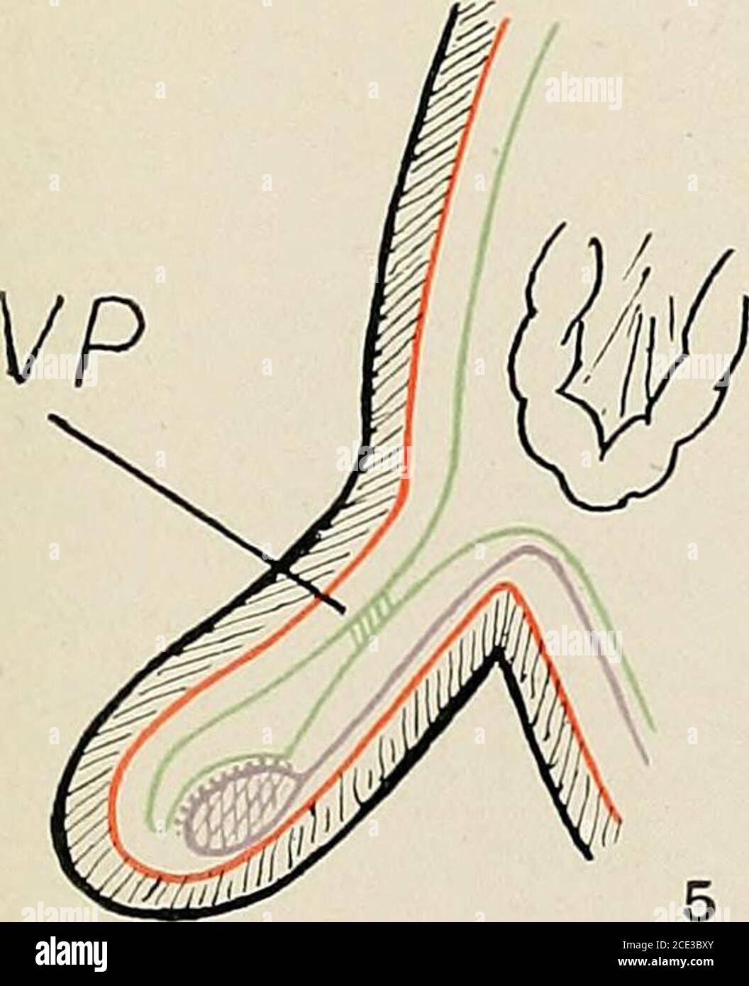 . Operative surgery, for students and practitioners Stock Photo - Alamy