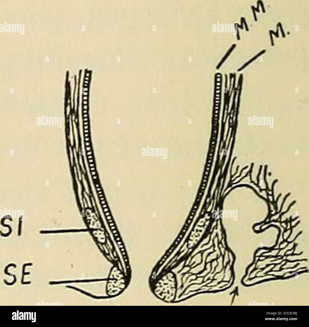 . Operative surgery, for students and practitioners . Fig. 168.—Blind ...