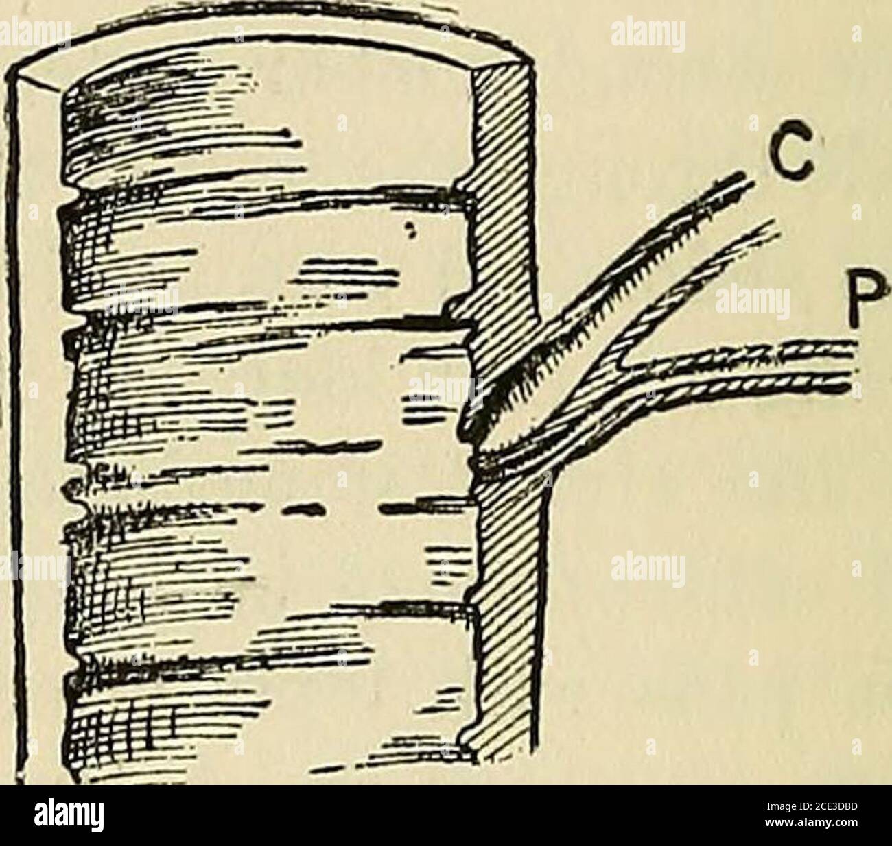 . Operative surgery, for students and practitioners . Fig. 163.—Segment ...