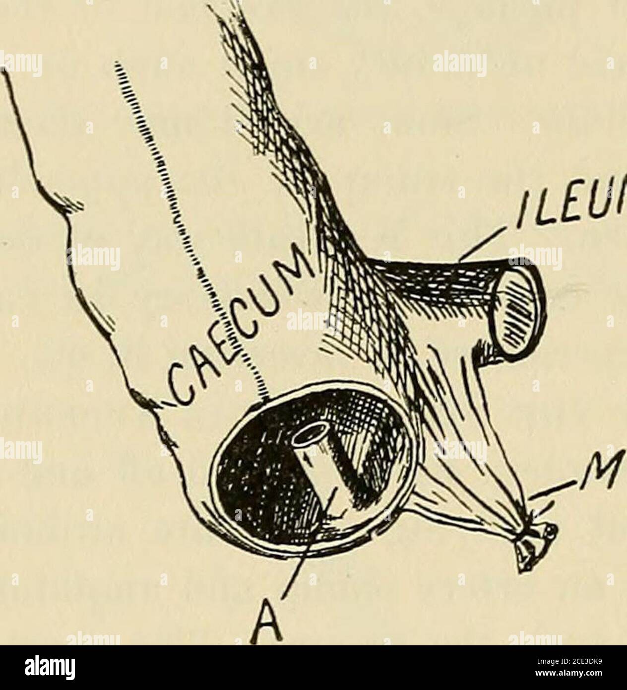 . Operative surgery, for students and practitioners . e caecum so as to ...