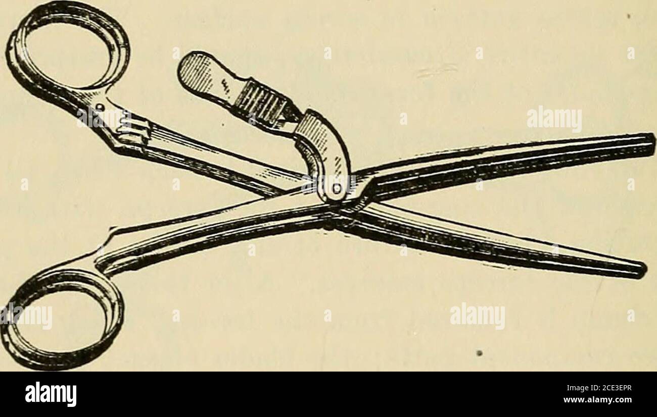 . Operative surgery, for students and practitioners . Fig. 140.—OHara ...