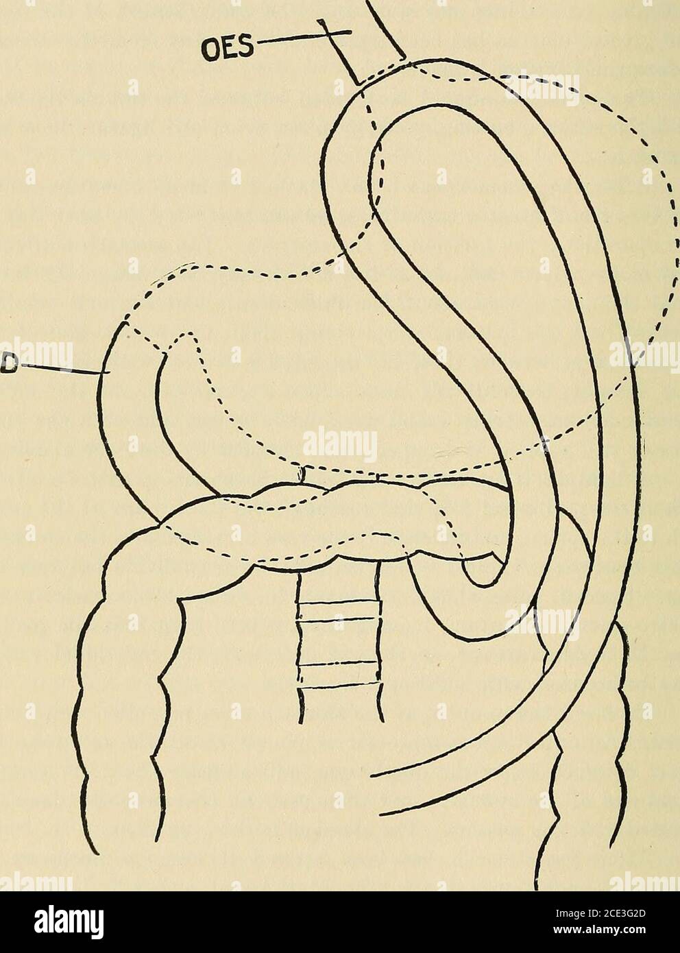 . Operative surgery, for students and practitioners . ndividual ...