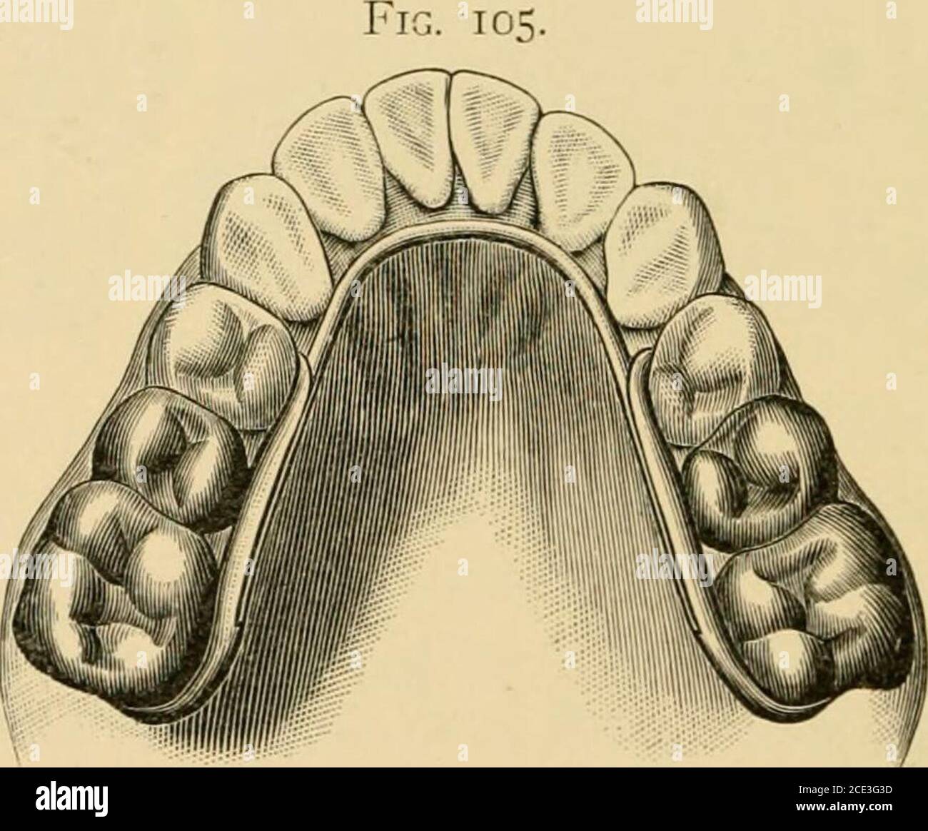 . A manual of mechanical dentistry and metallurgy . Protrusion of the ...
