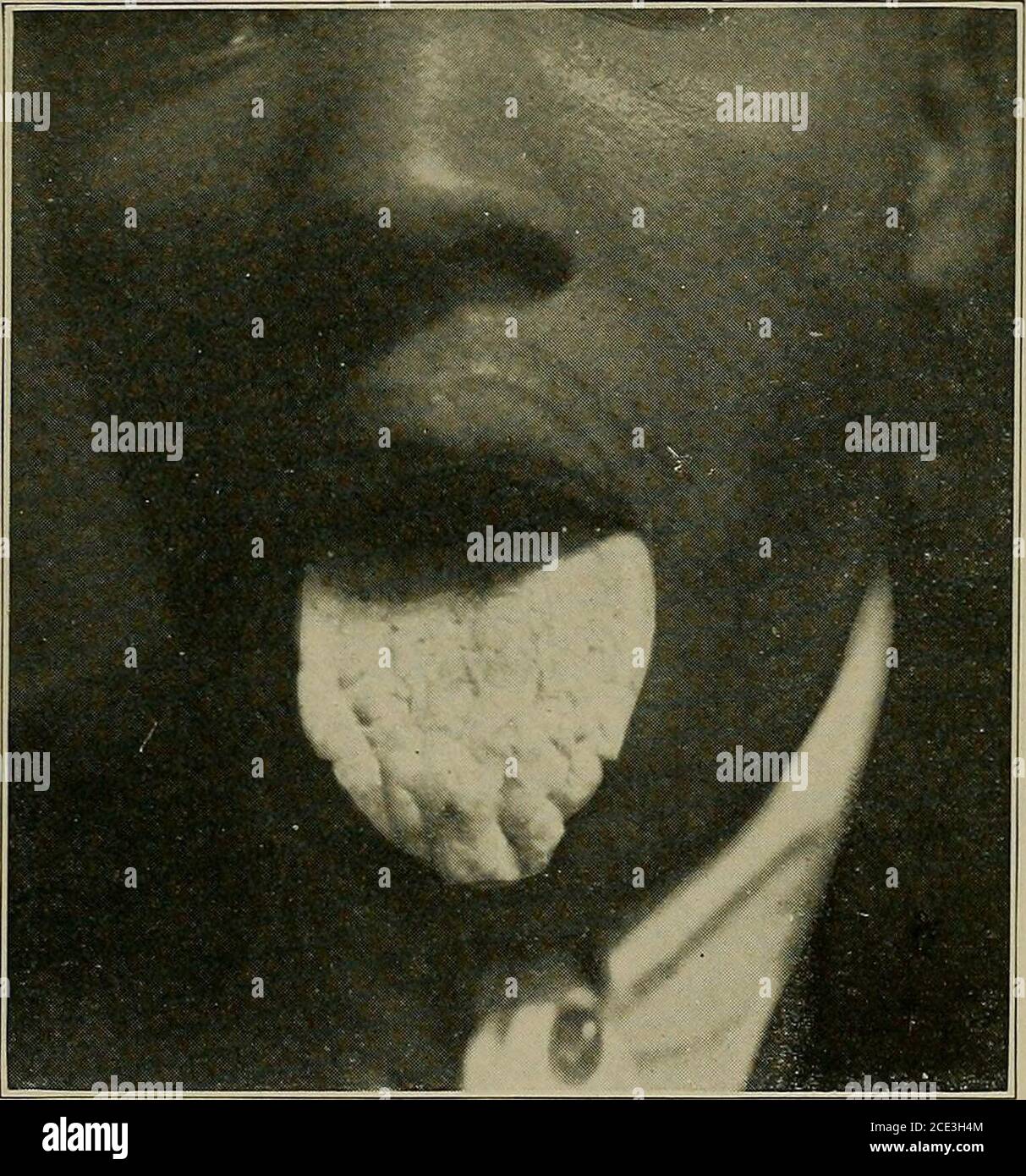 Take down swelling hi-res stock photography and images - Alamy