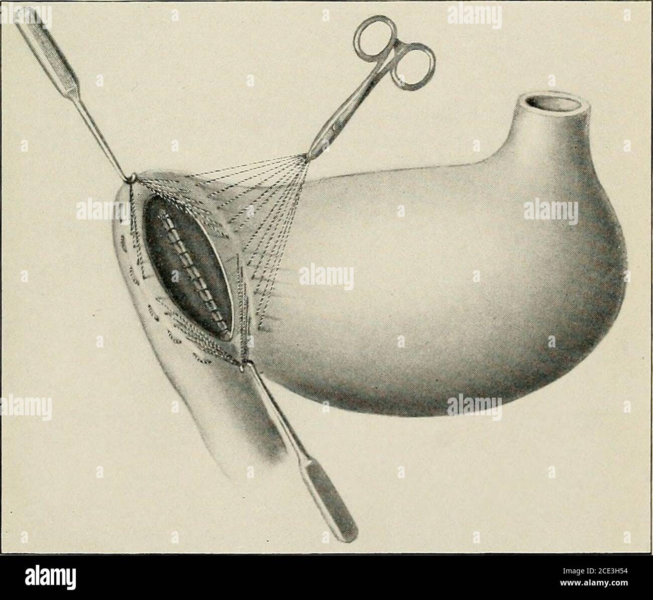 . Operative surgery, for students and practitioners . Fig. 104 ...