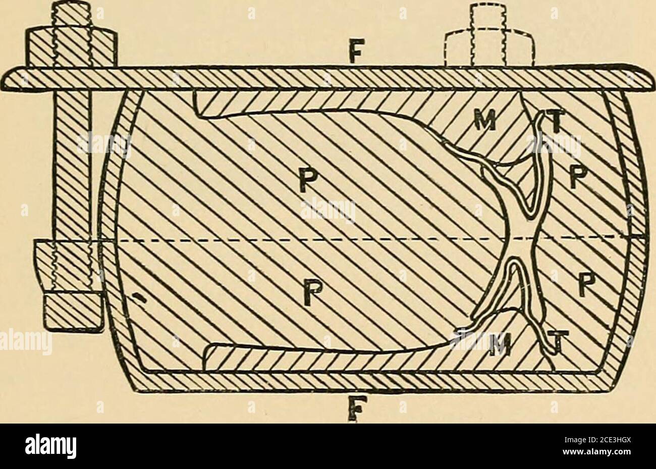Bite splints hi-res stock photography and images - Alamy