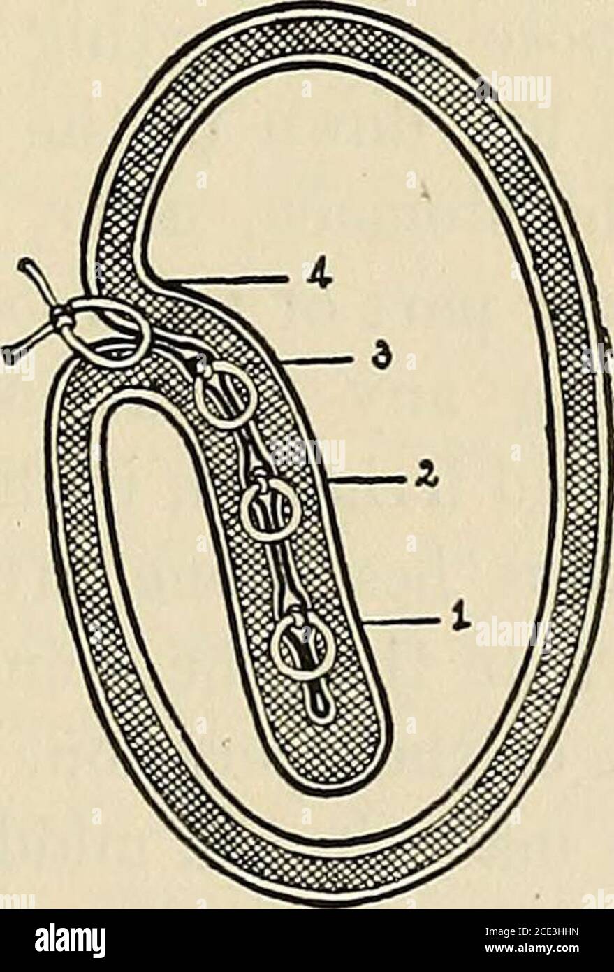 . Operative surgery, for students and practitioners . Fig. 97.—Cross ...