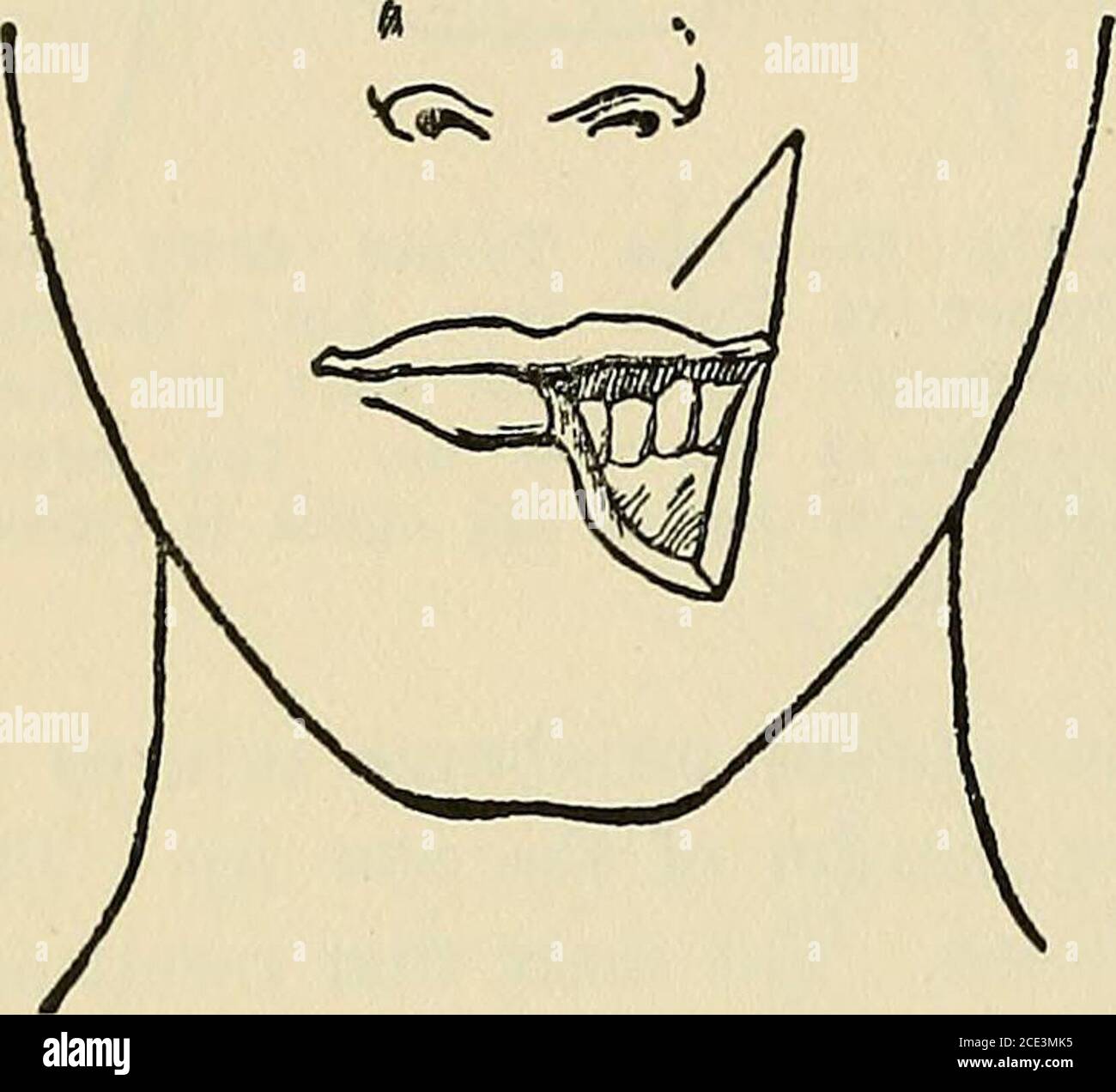 . Operative surgery, for students and practitioners . nd Su- Btoring ...