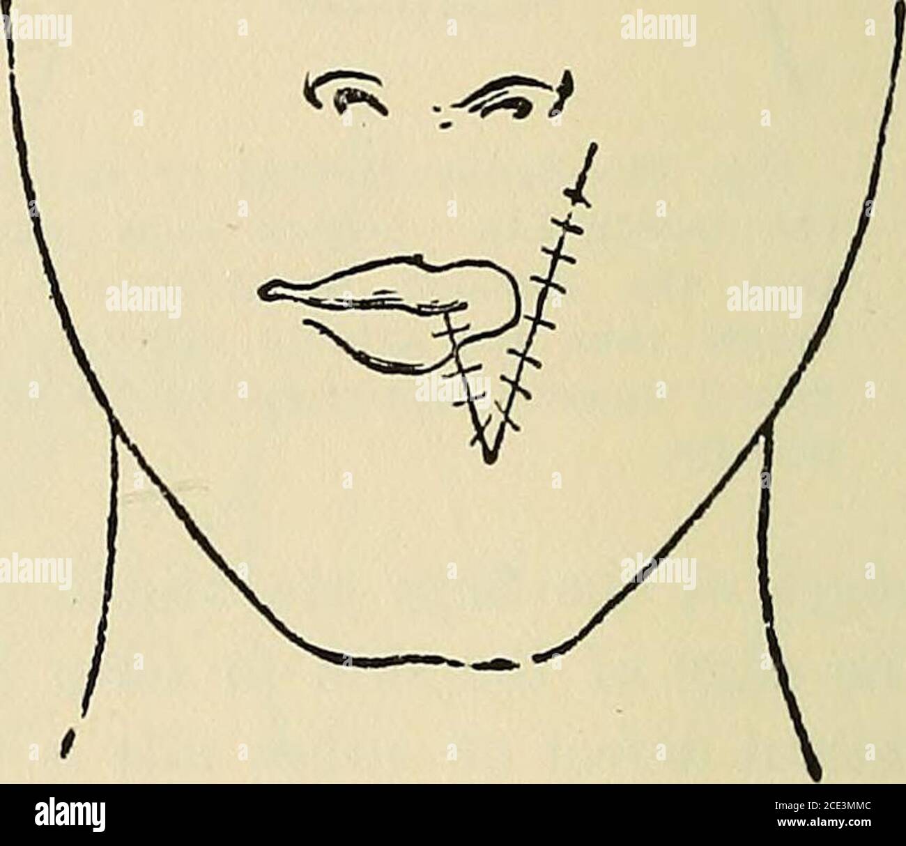 Flap closing hi-res stock photography and images - Alamy