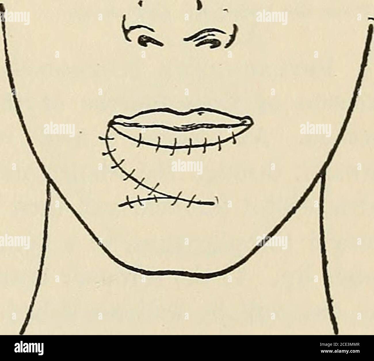 Upper lip raised hi-res stock photography and images - Alamy