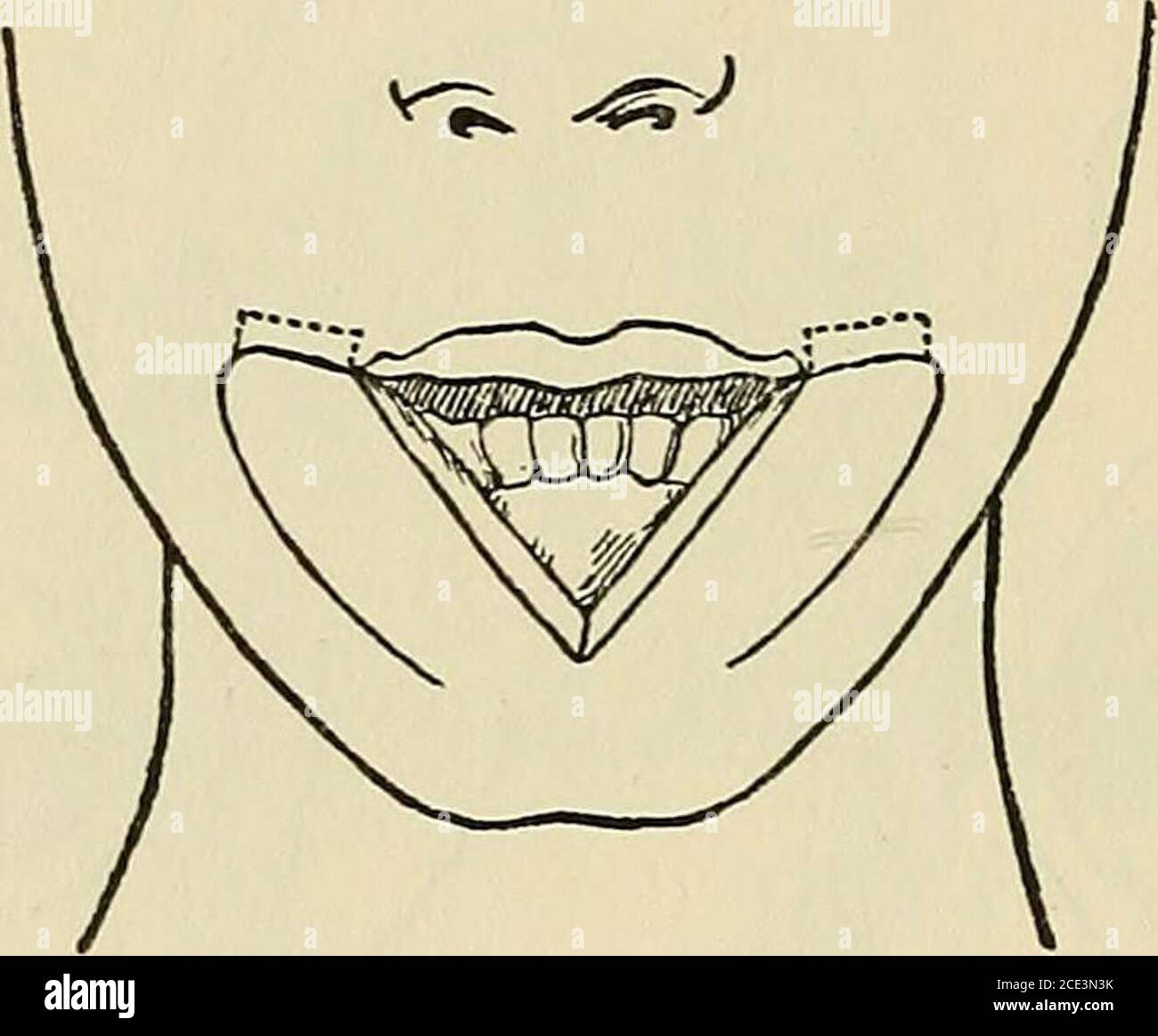 . Operative surgery, for students and practitioners . of each of these ...