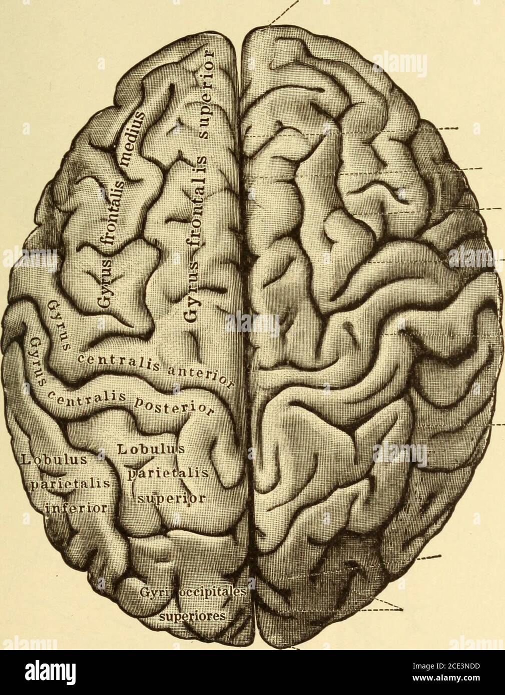 . Diseases of the nervous system . the mus-cle areas affected by ...