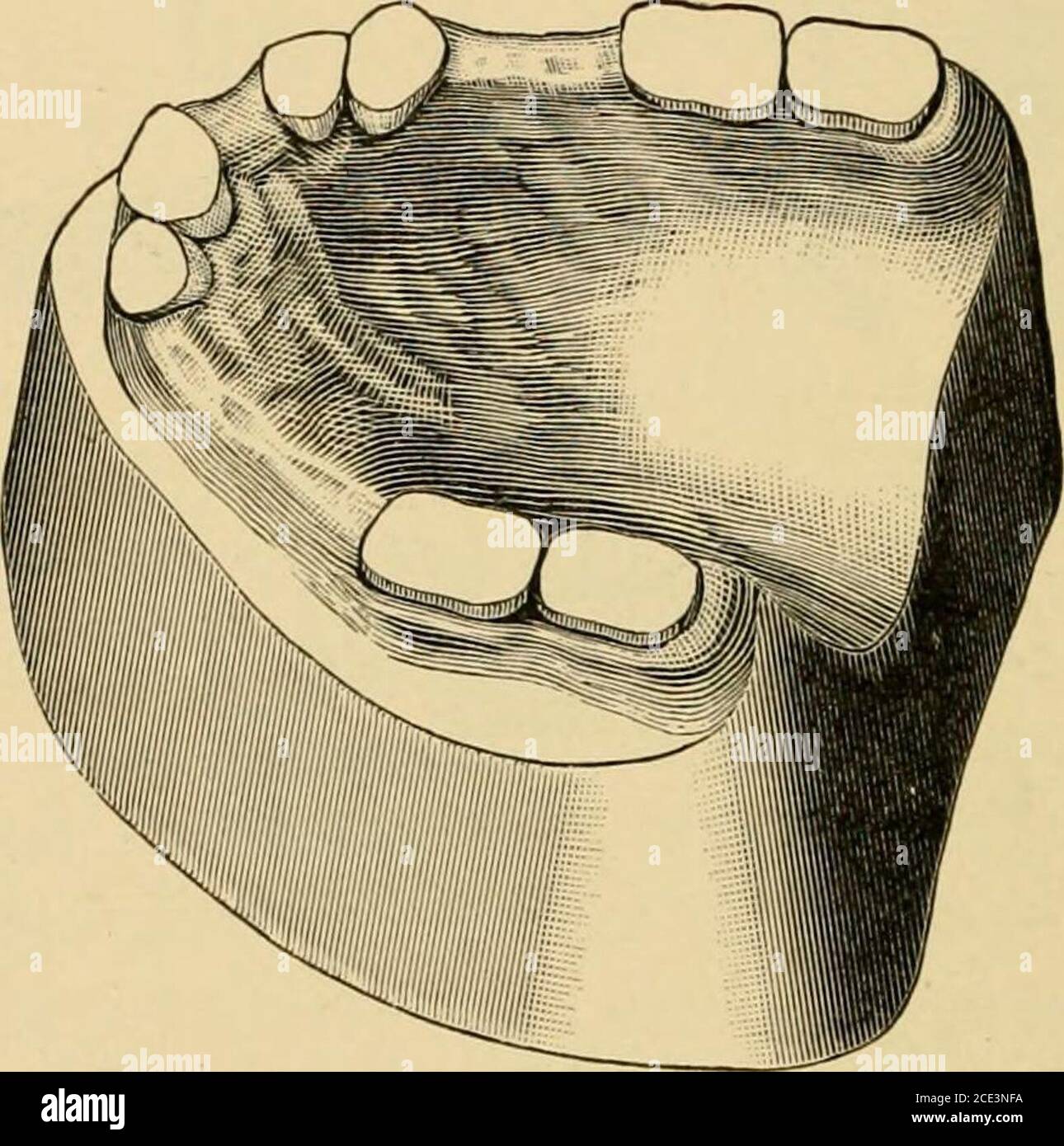 Alveolar ridge hi-res stock photography and images - Alamy