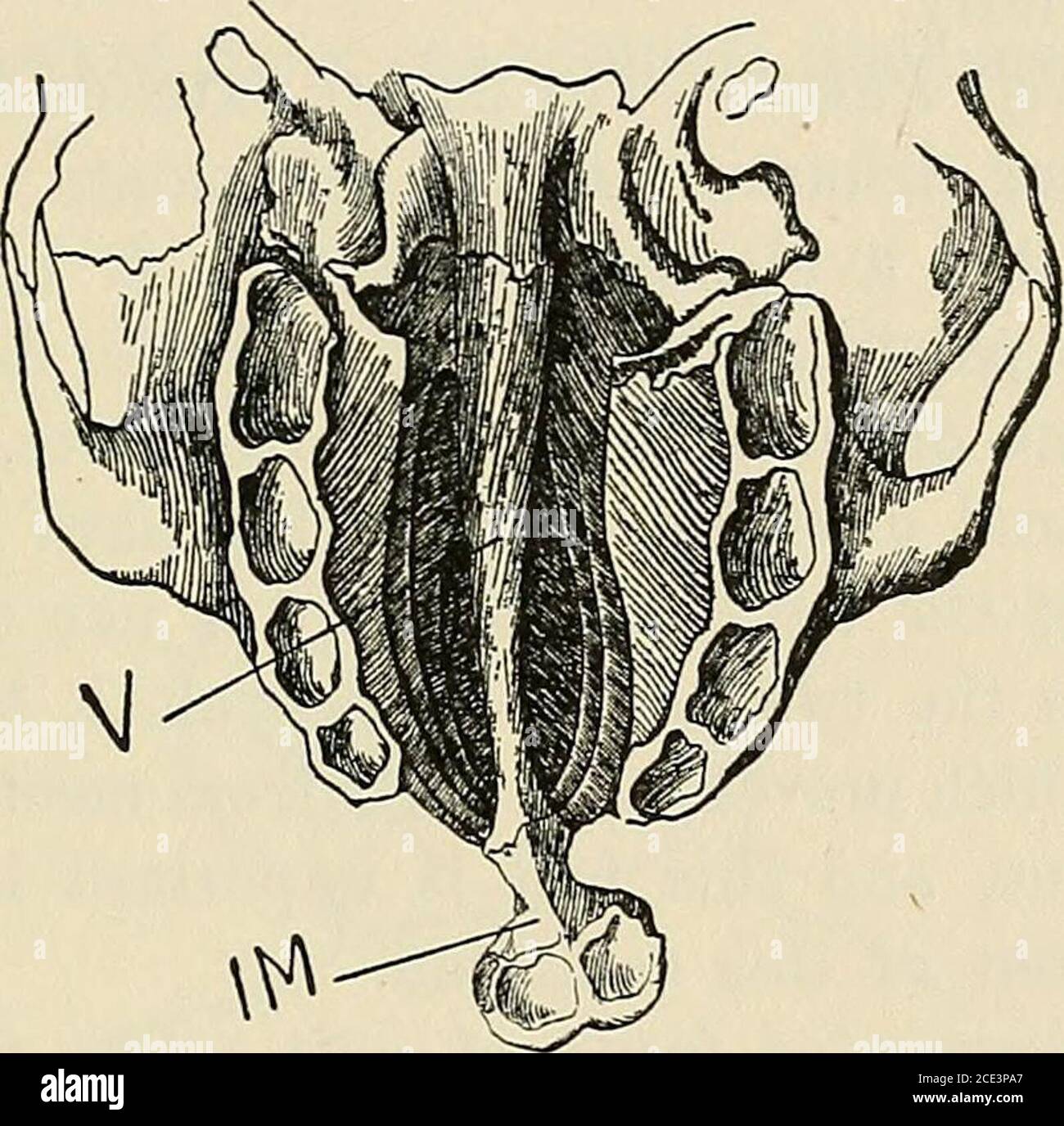Congenital deformities hi-res stock photography and images - Alamy
