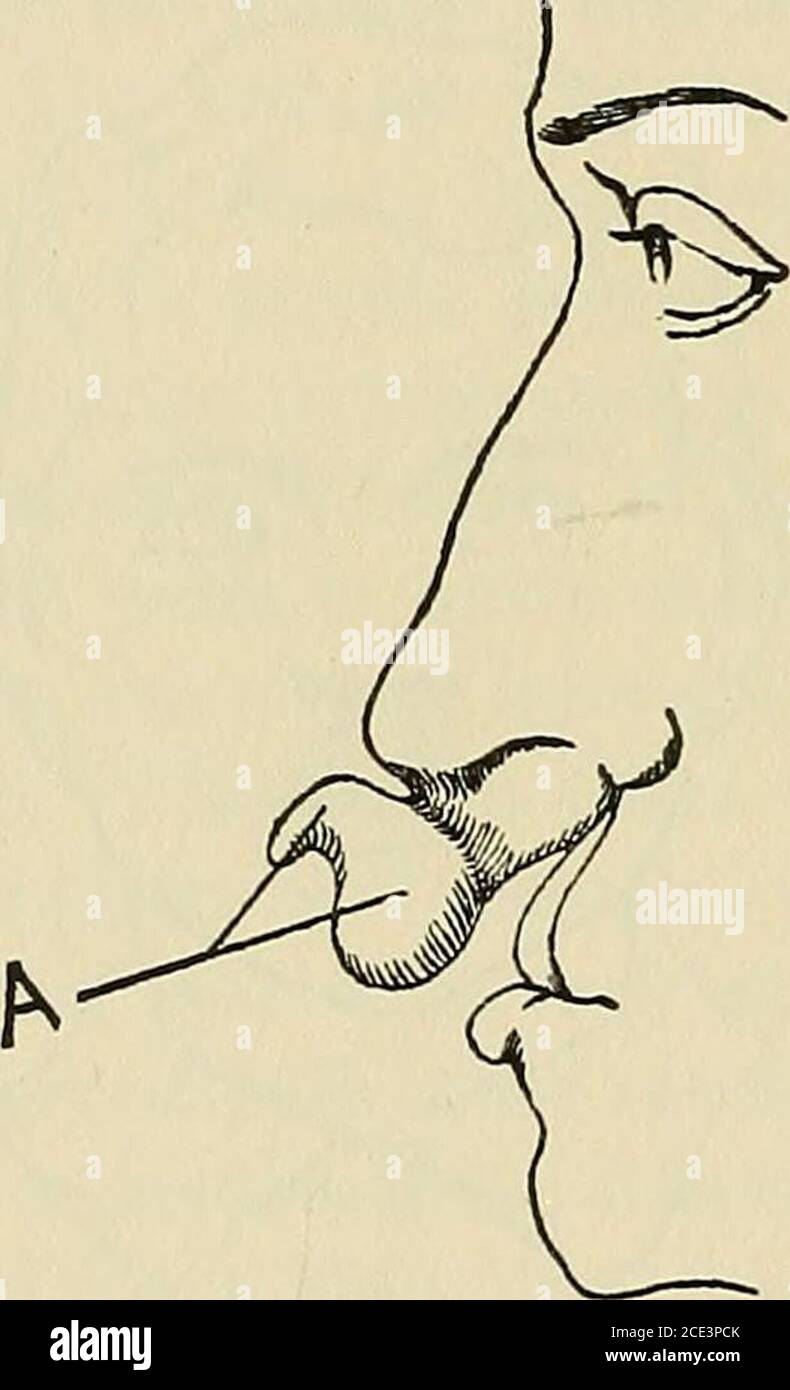 Intermaxillary bone hi-res stock photography and images - Alamy