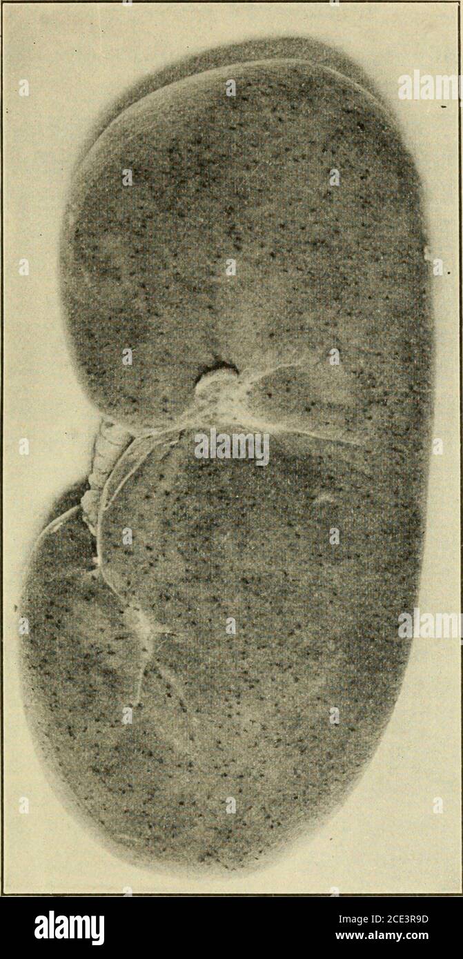 . Hog cholera, its nature and control . 1/4 to 2 centimeters in ...