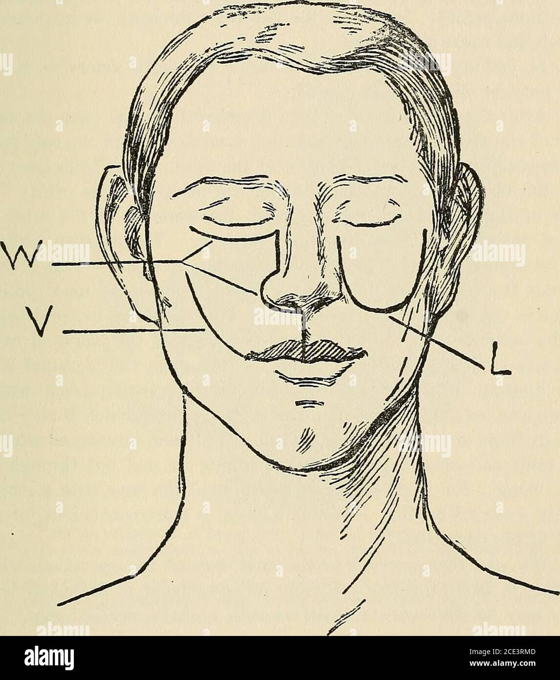 Inner incision hi-res stock photography and images - Alamy