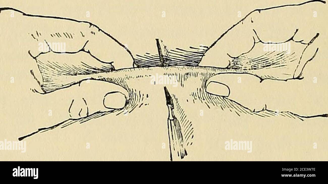 . Operative surgery, for students and practitioners . d with the ...