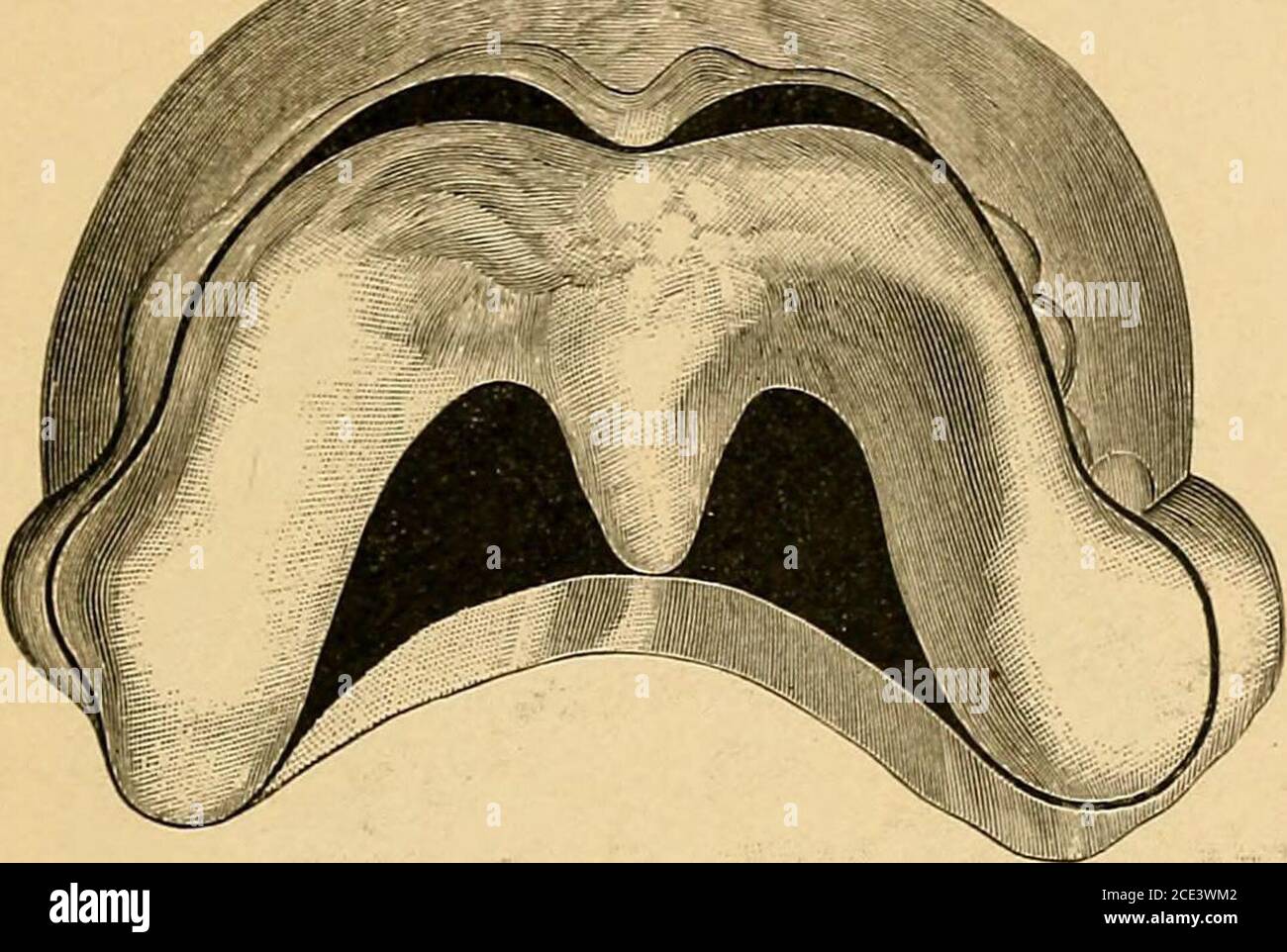 Alveolar ridge hi-res stock photography and images - Alamy