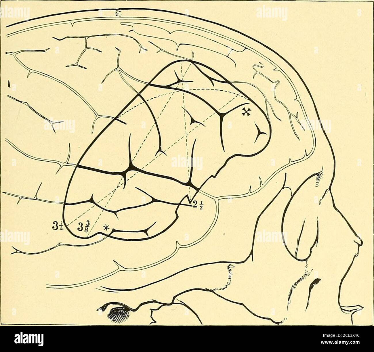 . Some points in the surgery of the brain and its membranes . Fig. 147 ...