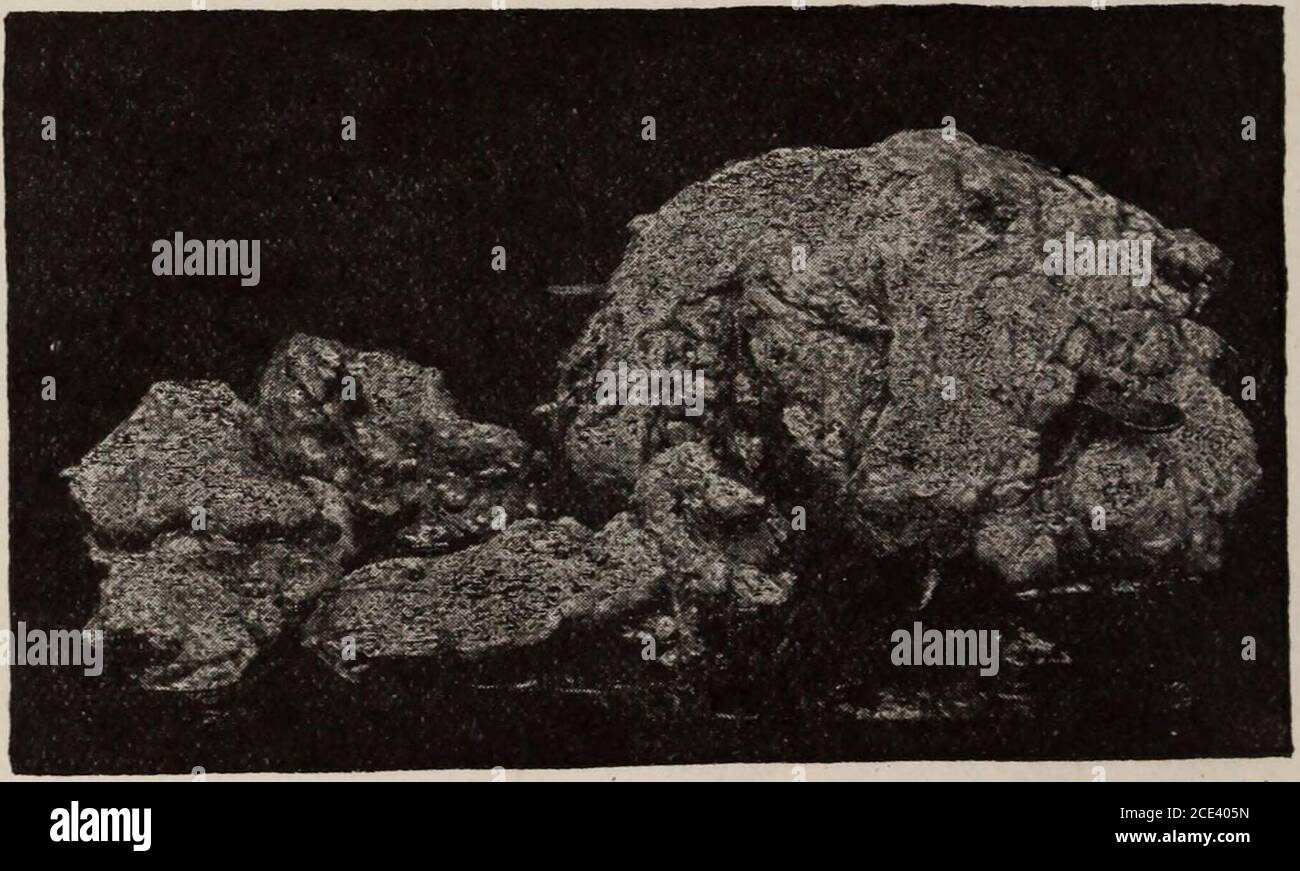 In emaciated body hi-res stock photography and images - Alamy