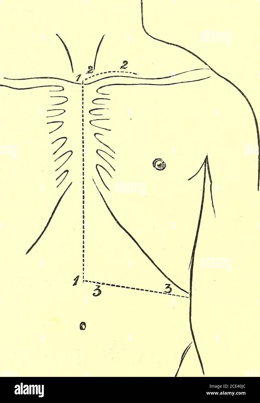 . A manual of dissections of the human body [electronic resource] : for ...