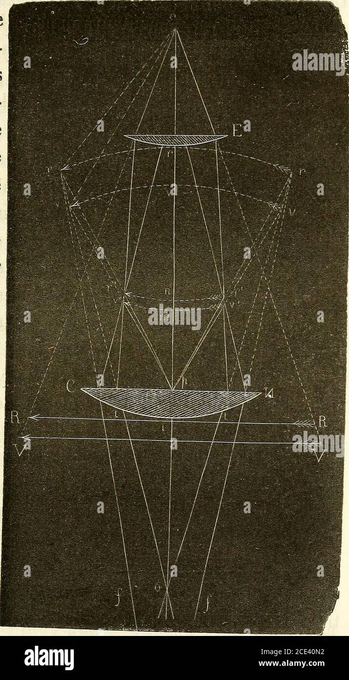 Pathologie oculaire hi-res stock photography and images - Alamy