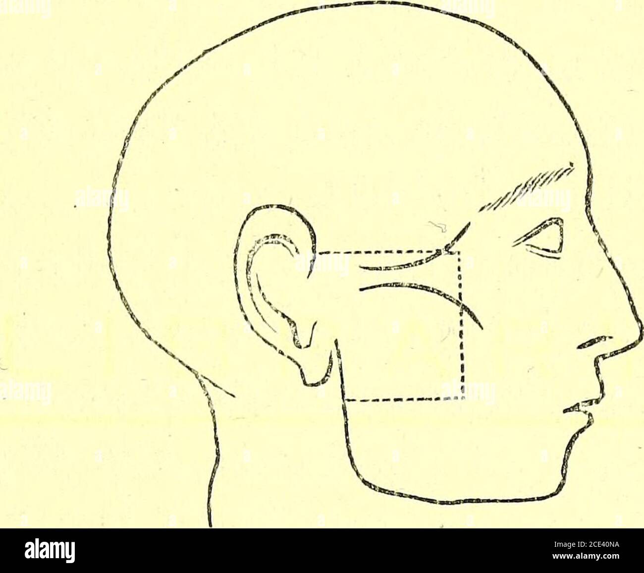 Transverse facial vein hi-res stock photography and images - Alamy