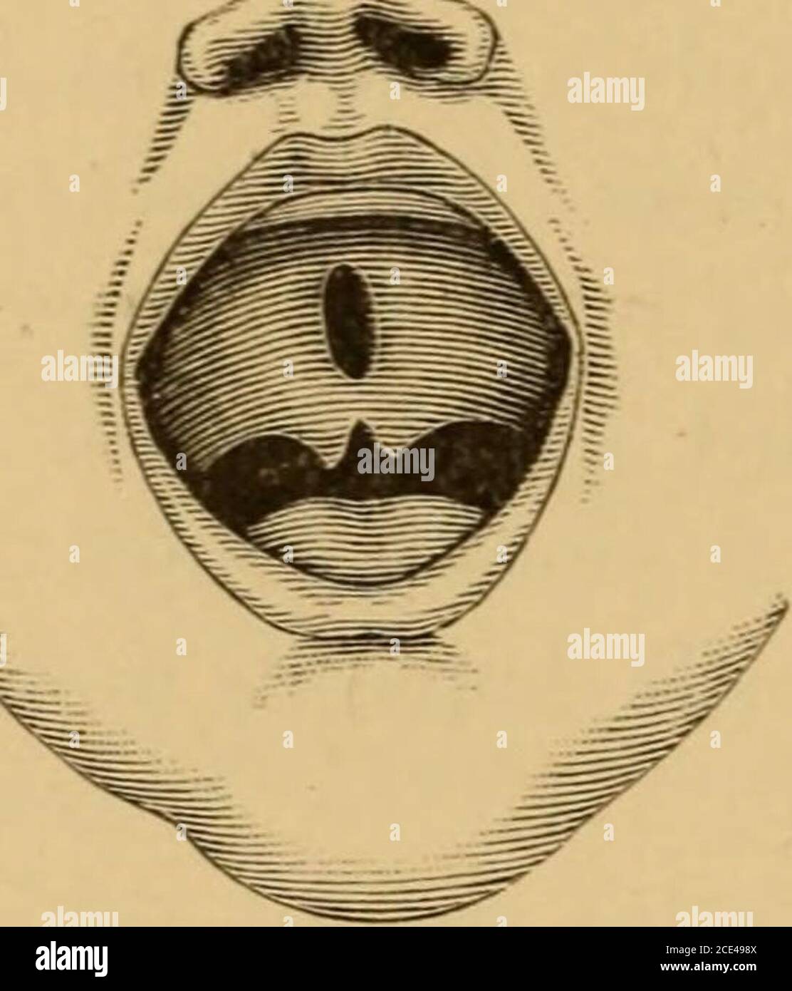 Mass retaining system hi-res stock photography and images - Alamy