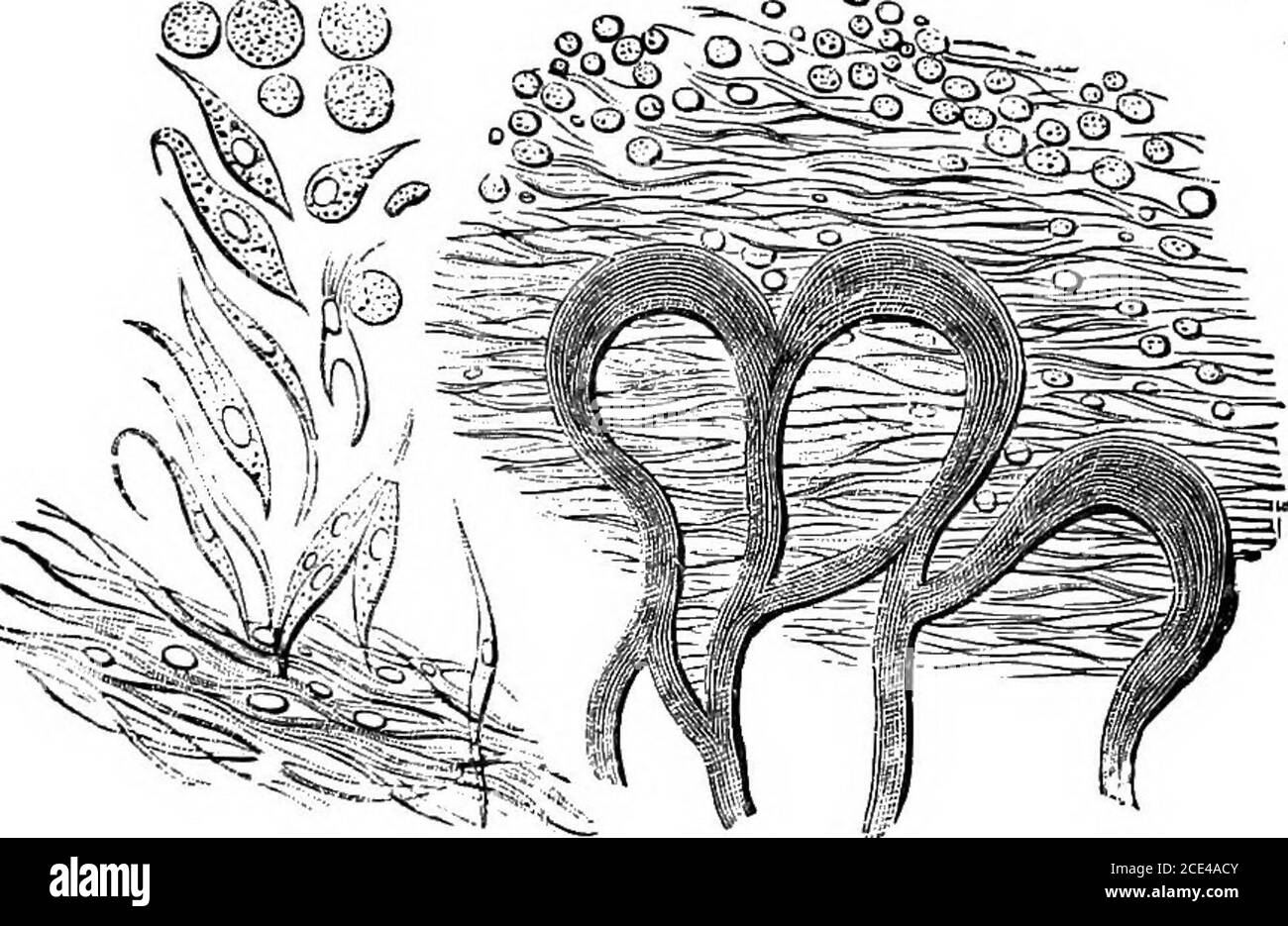 Vascular granulation Cut Out Stock Images & Pictures - Alamy