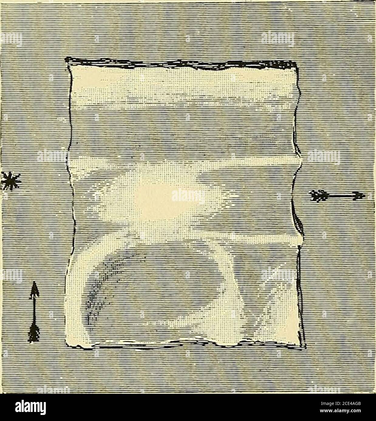 . Some points in the surgery of the brain and its membranes . Fig. 142 ...