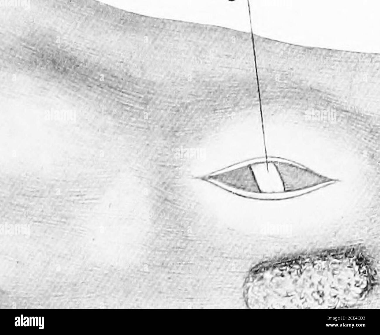 . The principles and practice of veterinary surgery . ^.. -a 3 DISEASES ...