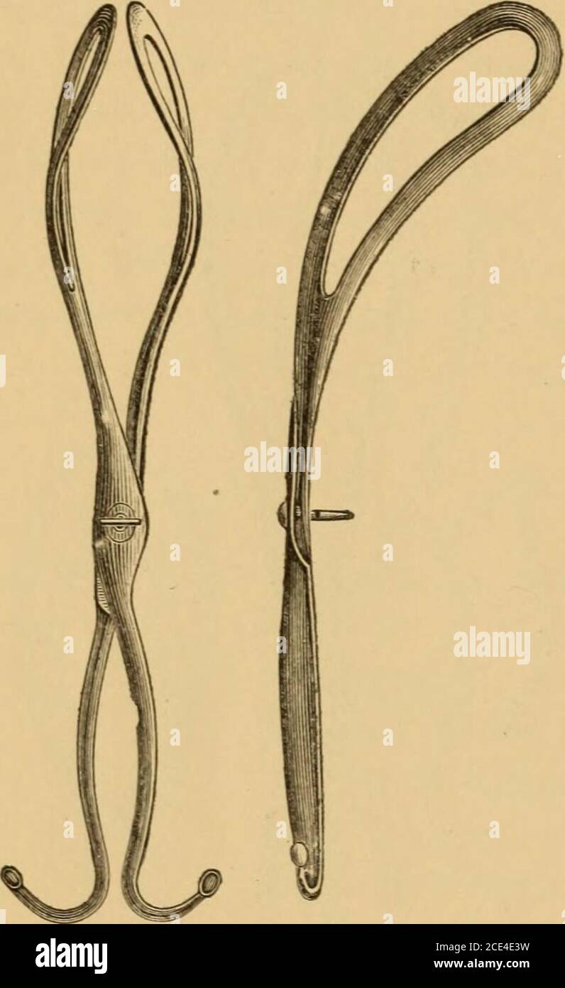 . A system of obstetrics . his short forceps, thus removing one of the ...