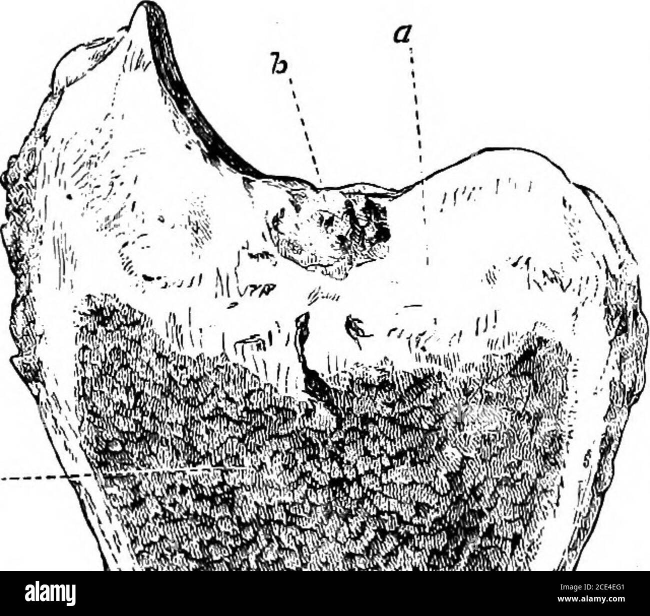 Bone deposition Black and White Stock Photos & Images - Alamy