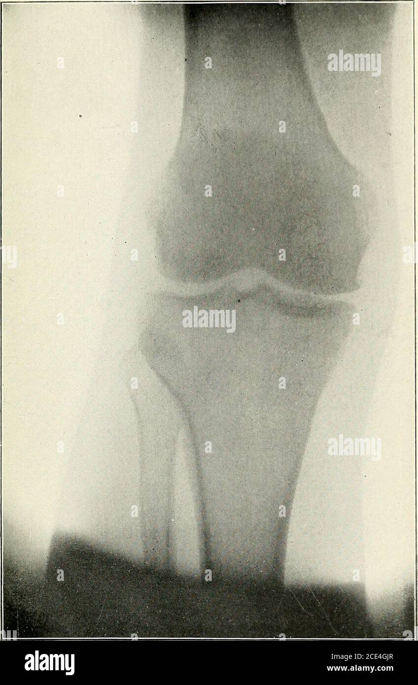The classification and treatment of diseases commonly known as rheumatism