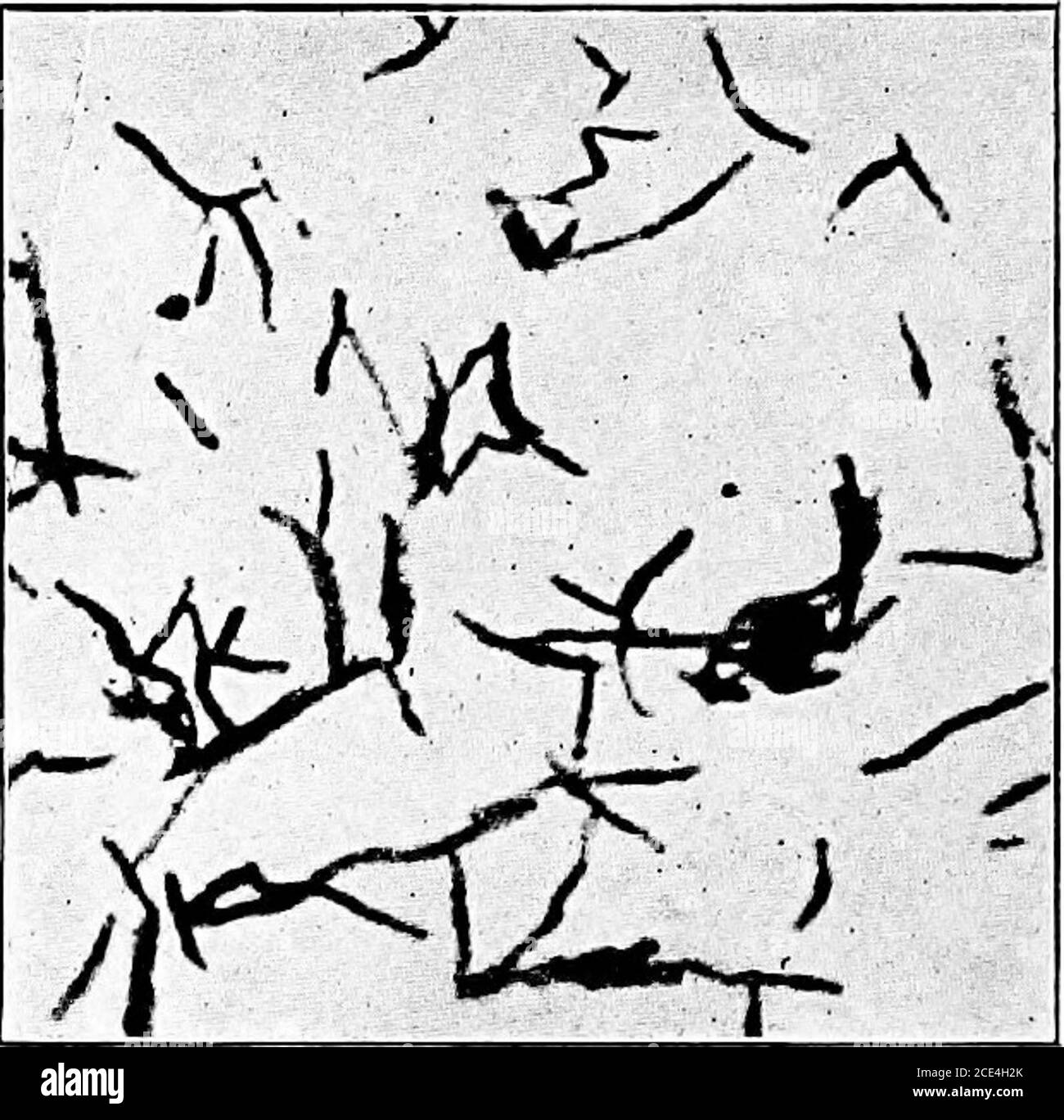 Bacteria pin hi-res stock photography and images - Alamy