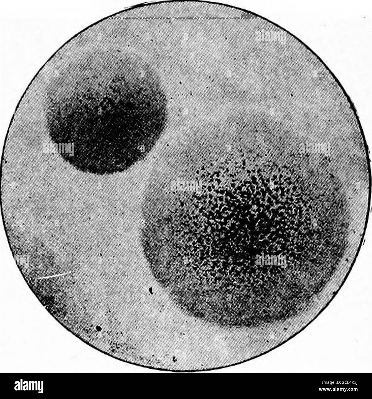 Neonatorum hi-res stock photography and images - Alamy
