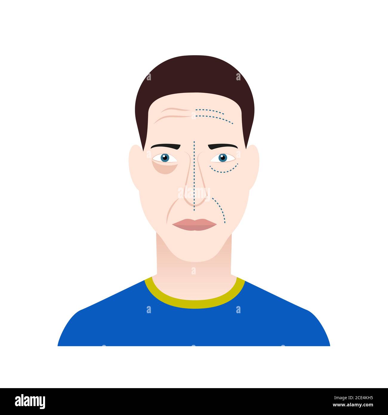 Man face before and after face lifting Vector illustration in flat ...
