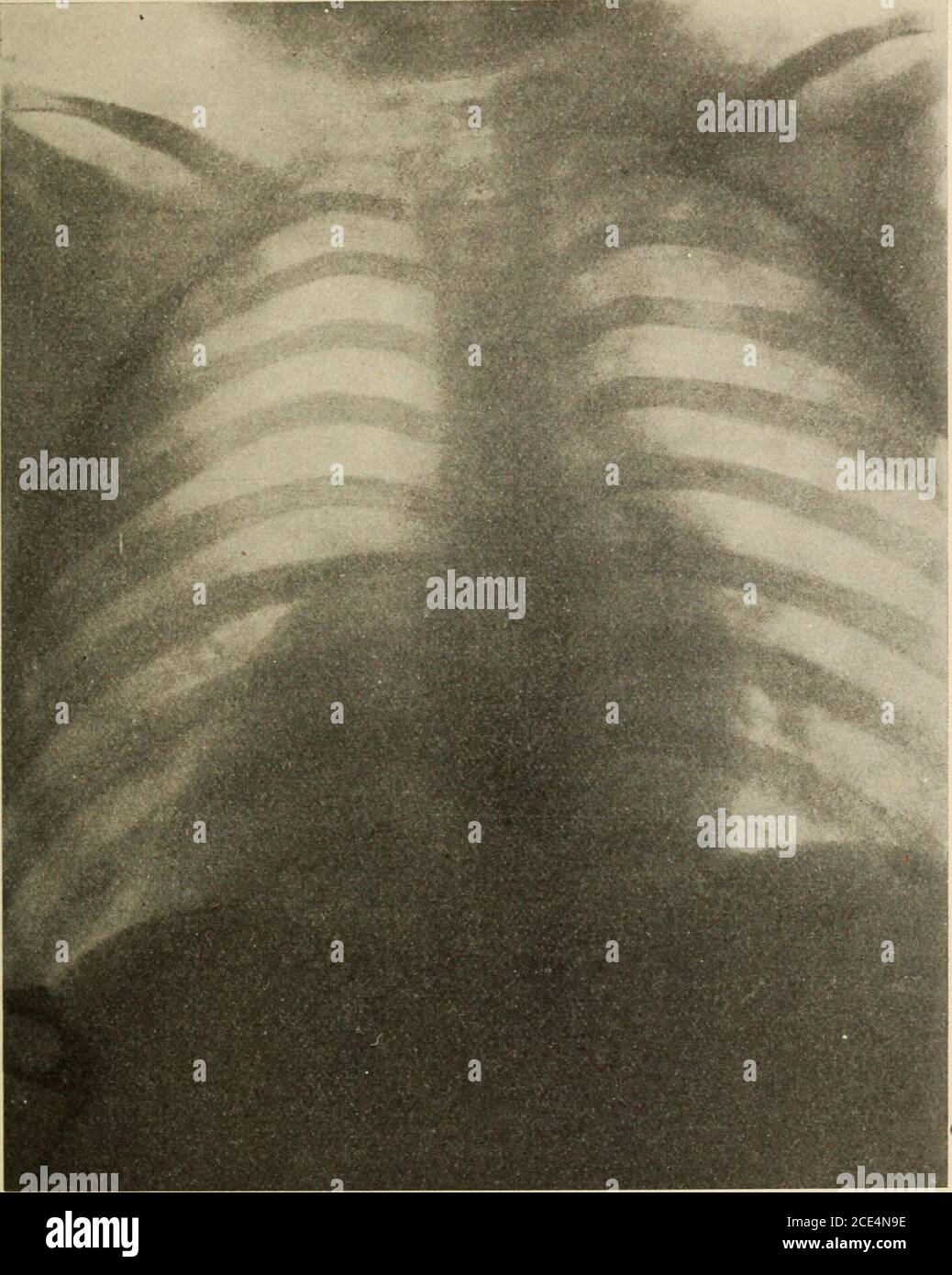 . The Hahnemannian monthly . to the leftand considerable to the right ...