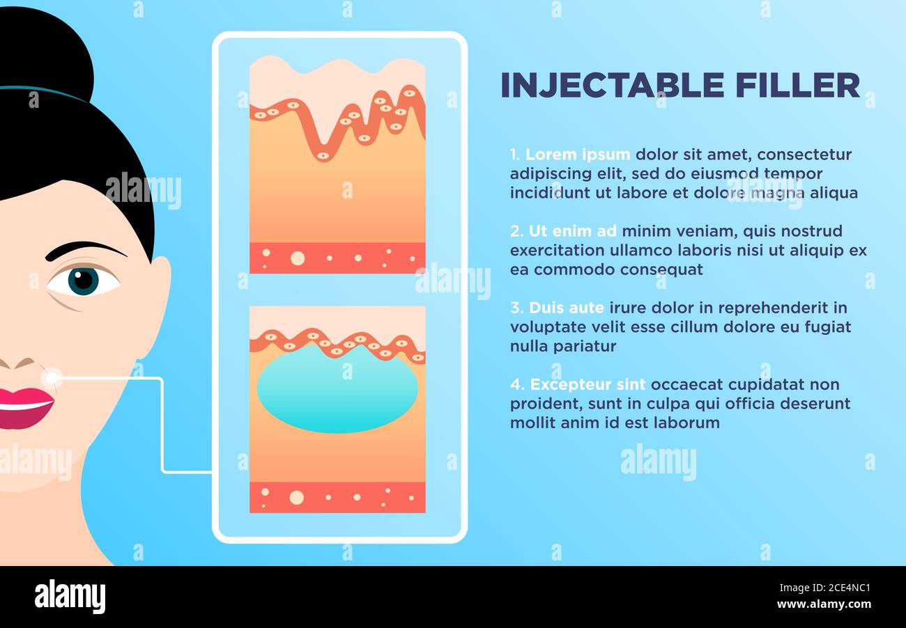 Cosmetology filler Vector illustration with copy space Stock Vector ...