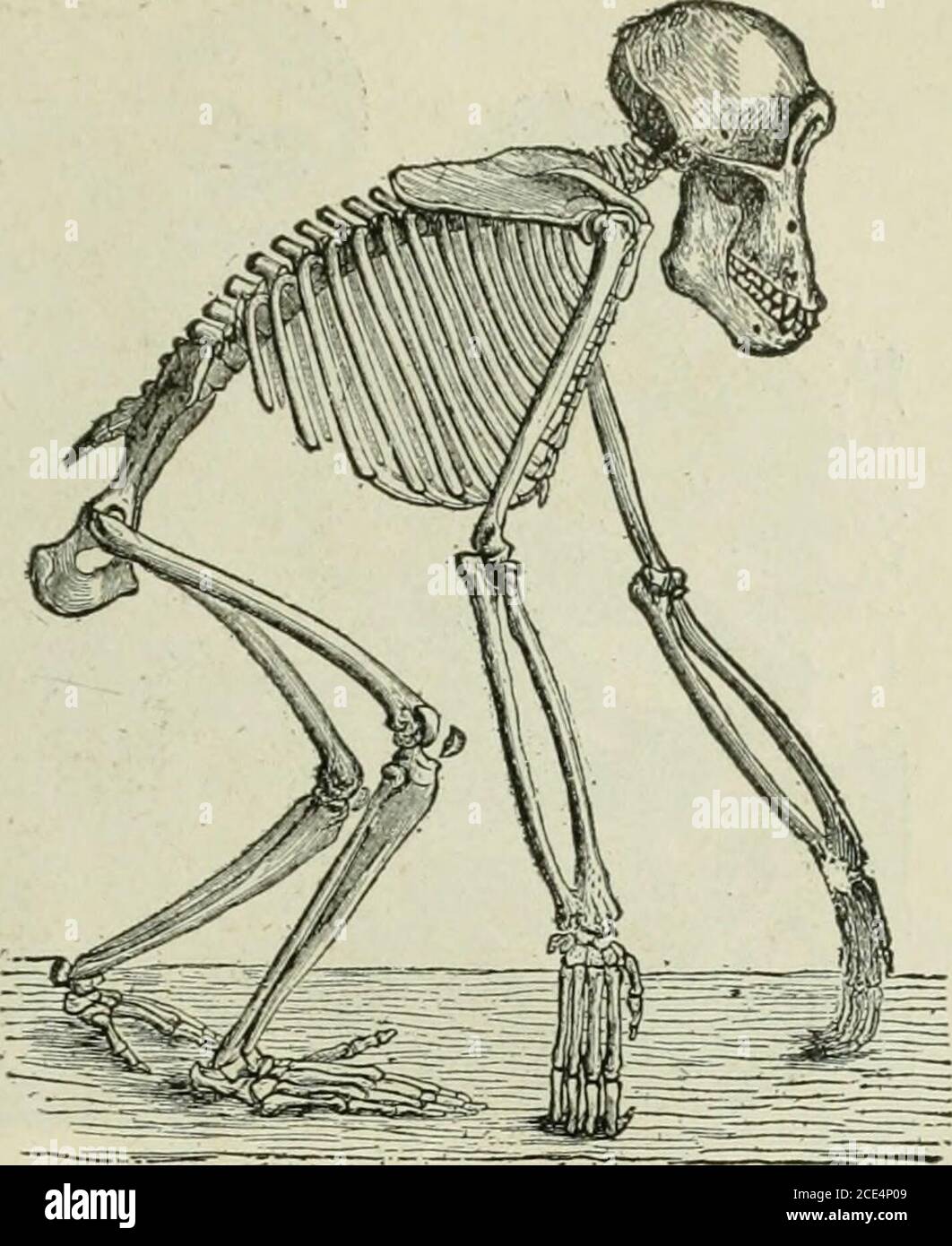 Modified limbs hi-res stock photography and images - Alamy