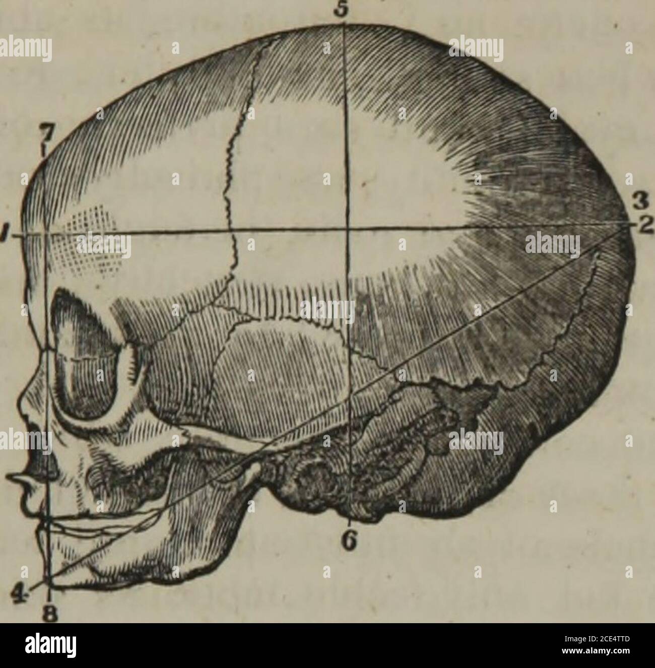 . On the theory and practice of midwifery . uteri, is that position in ...